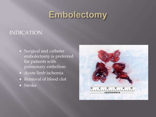 Surgical Procedures | PPTX | Heart and Cardiovascular Diseases ...