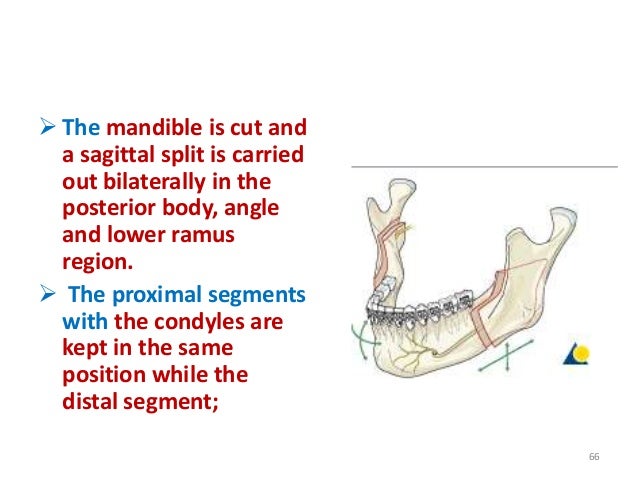 Surgical procedures for the treatment of