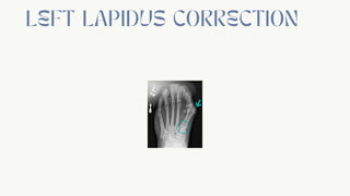 Surgical procedures & most used Sets.pdf