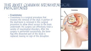 Surgical procedures & most used Sets.pdf