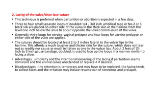 Surgical procedures on the vulva, vagina and.pdf