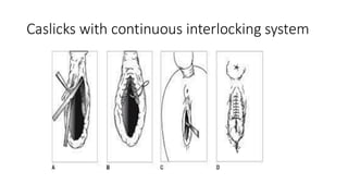 Surgical procedures on the vulva, vagina and.pdf