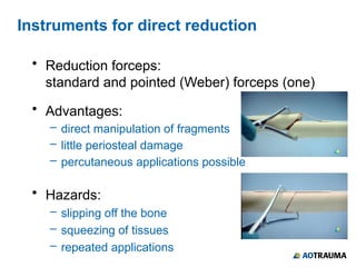 Surgical Reduction Techniques - AOTME.pptx