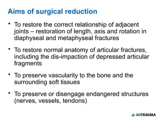 Surgical Reduction Techniques - AOTME.pptx