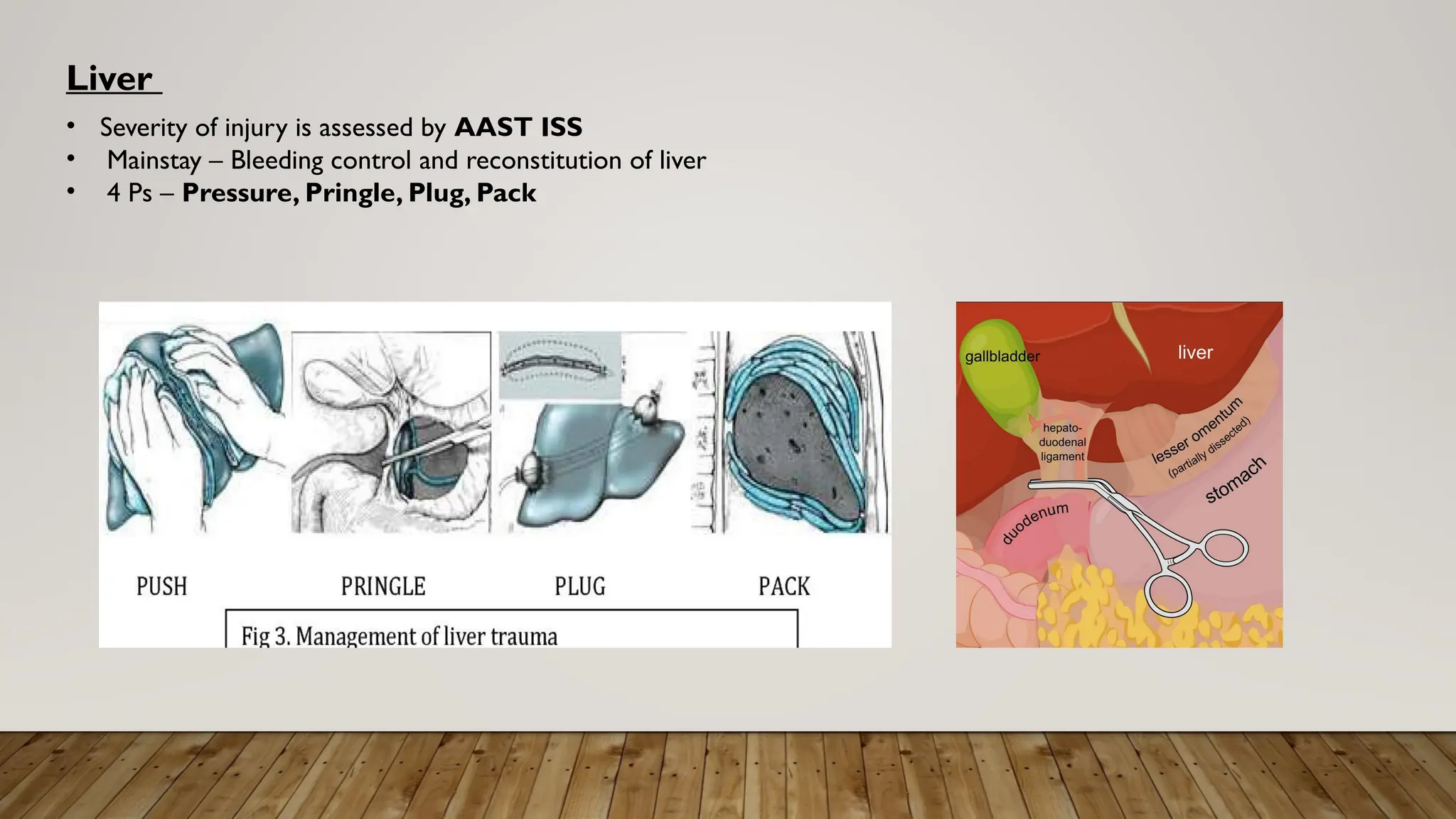 Surgical Methods in Organ Trauma - Surgical Resuscitation | PPTX
