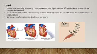 Surgical Methods in Organ Trauma - Surgical Resuscitation | PPTX