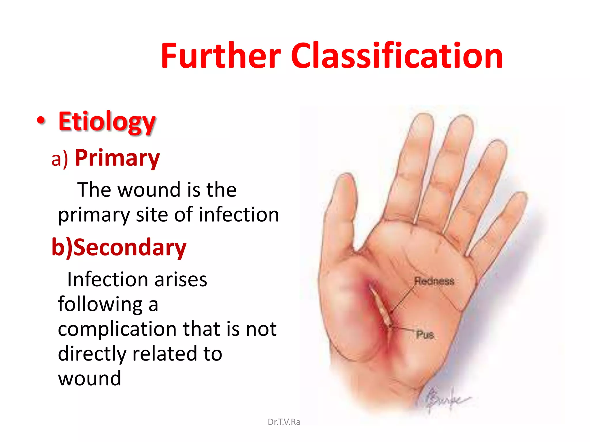 SURGICAL SITE INFECTIONS PREVENTION AND CARE | PPTX