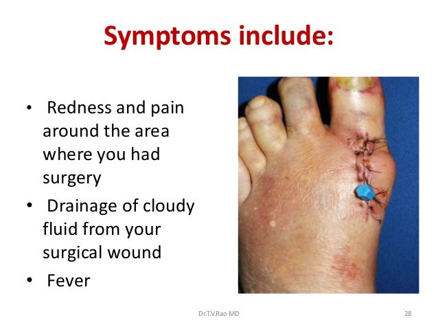 SURGICAL SITE INFECTIONSv PREVENTION AND CARE