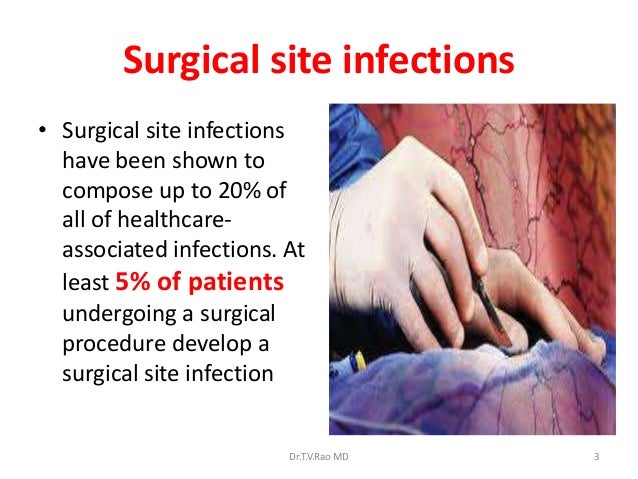 SURGICAL SITE INFECTIONS PREVENTION AND CARE