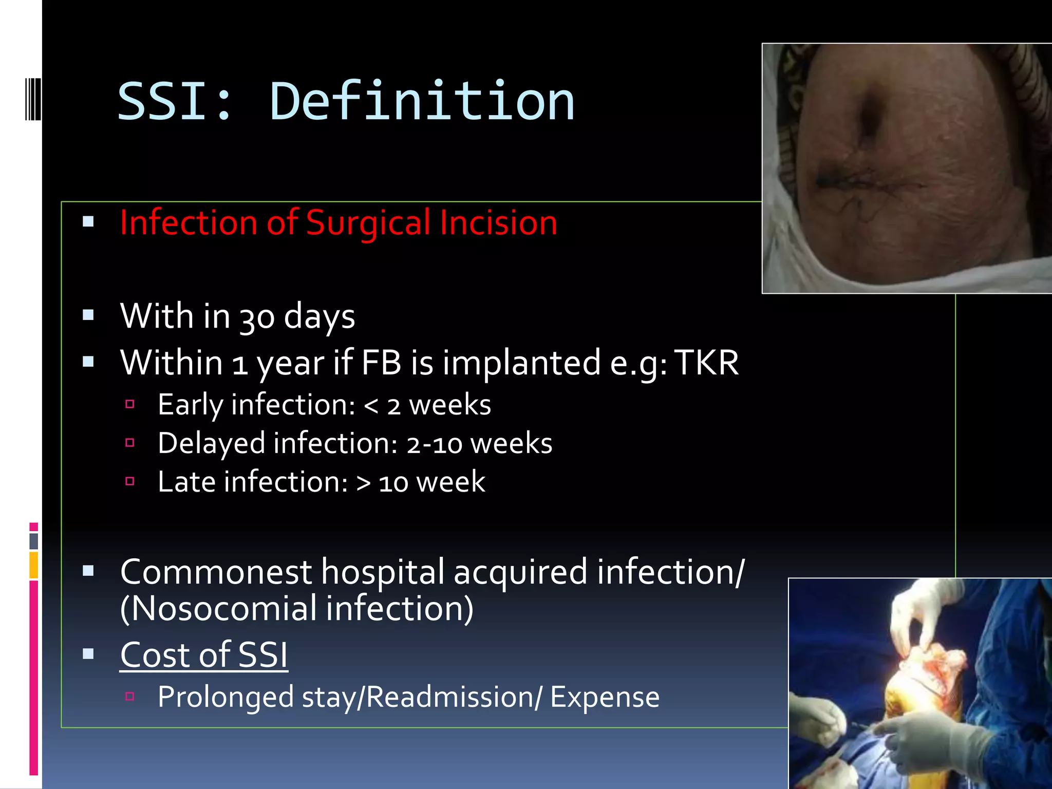 Surgical site infection | PPTX