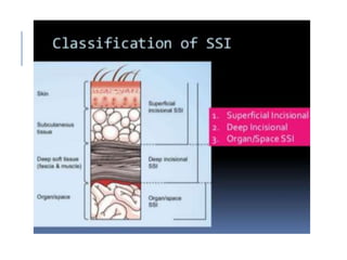 Surgical site infection - Recent Guidelines | PPTX