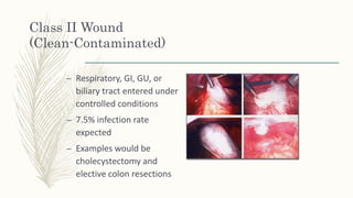 Surgical site infection | PPTX | Infectious Diseases | Diseases and ...