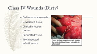 Surgical site infection | PPTX