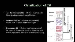 Surgical site infection | PPT