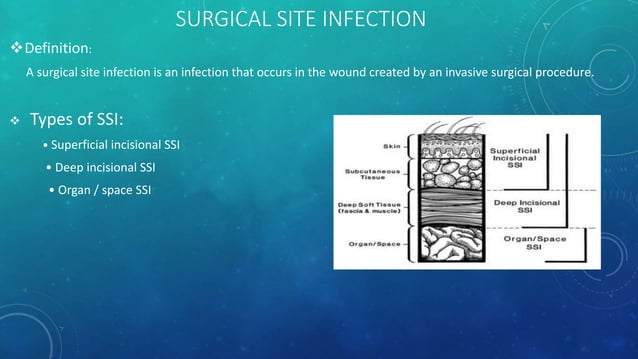 surgical site infection.pptx