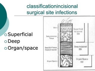 Surgical site Infection and classification.ppt