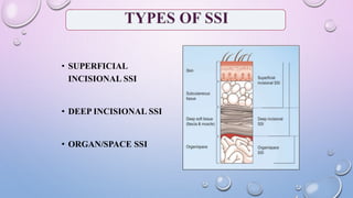 SURGICAL SITE INFECTION (SSI). PPT .pdf