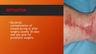 Surgical site infection revised | PPTX