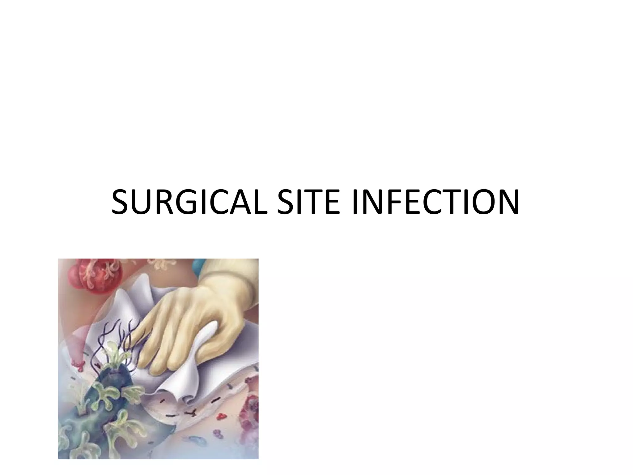 Surgical site infection (2) | PPT