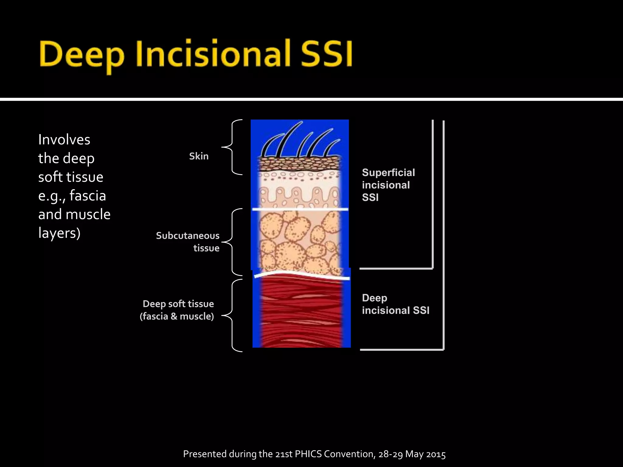 Surgical site infection 2015 | PDF