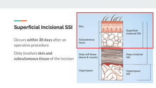 Surgical Site Infections, pathophysiology, and prevention.pptx