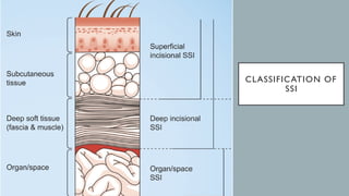 surgical site infections gangrene diabetic | PPT
