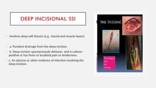 surgical site infections gangrene diabetic | PPTX