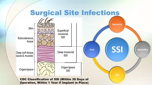 Surgical Site Infections (SSI) | PDF