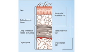 Surgical Site Infection & Wound Dehiscence .pdf