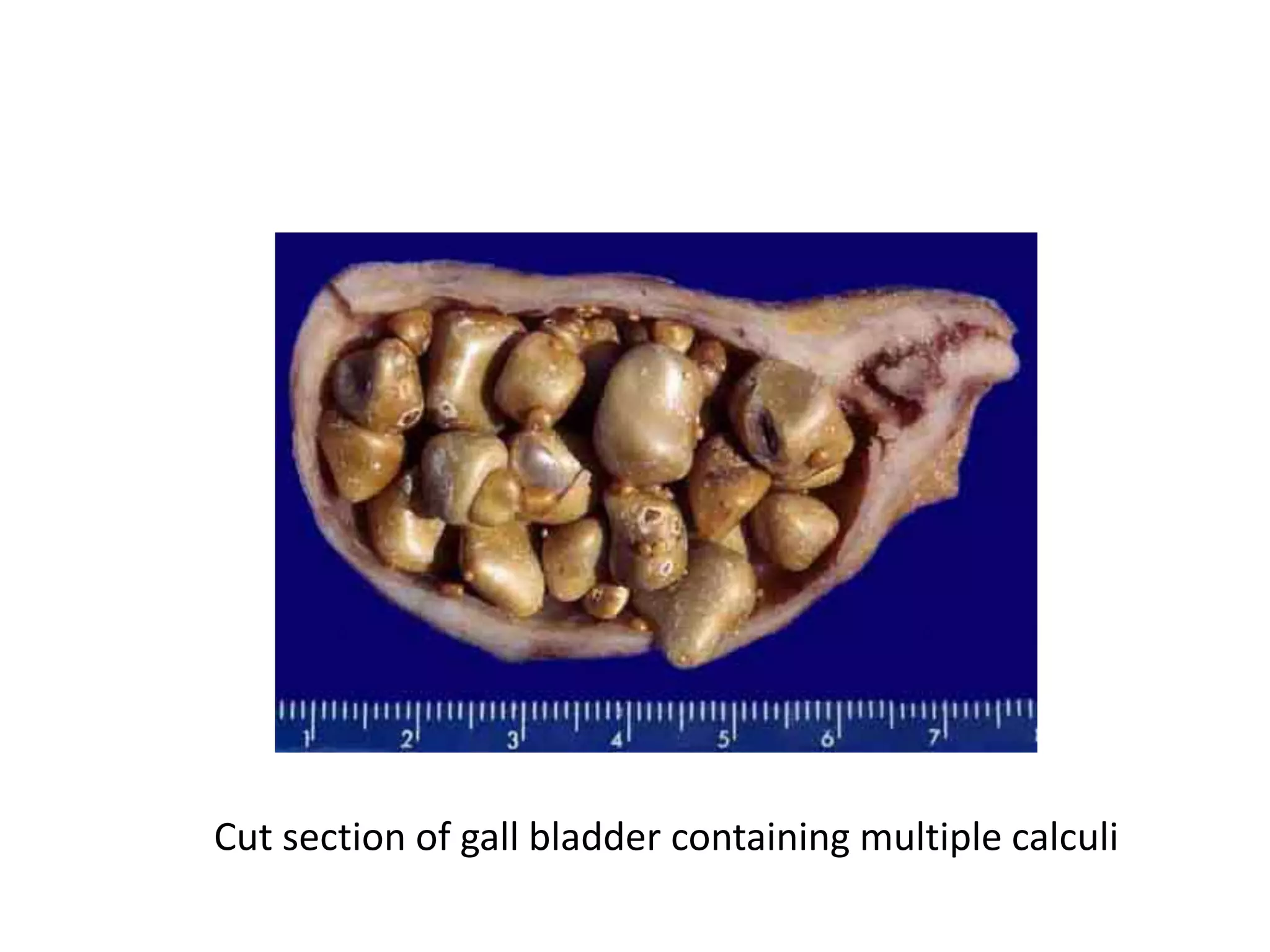 Surgical pathology specimens | PPTX