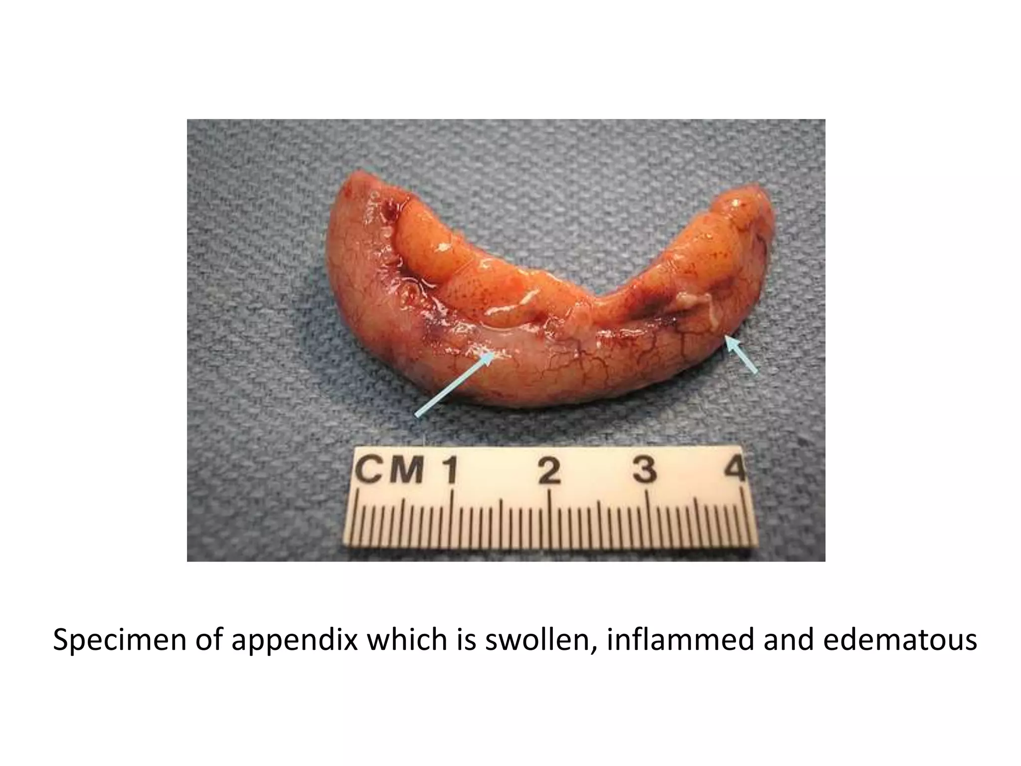 Surgical pathology specimens | PPTX