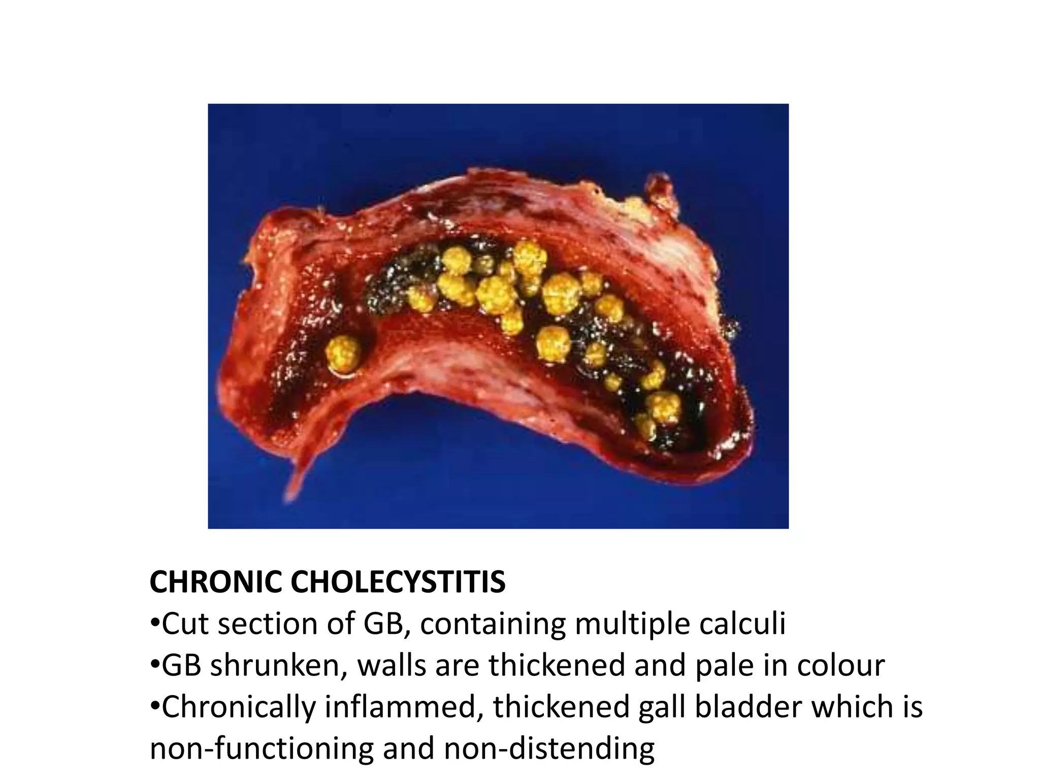Surgical pathology specimens | PPTX