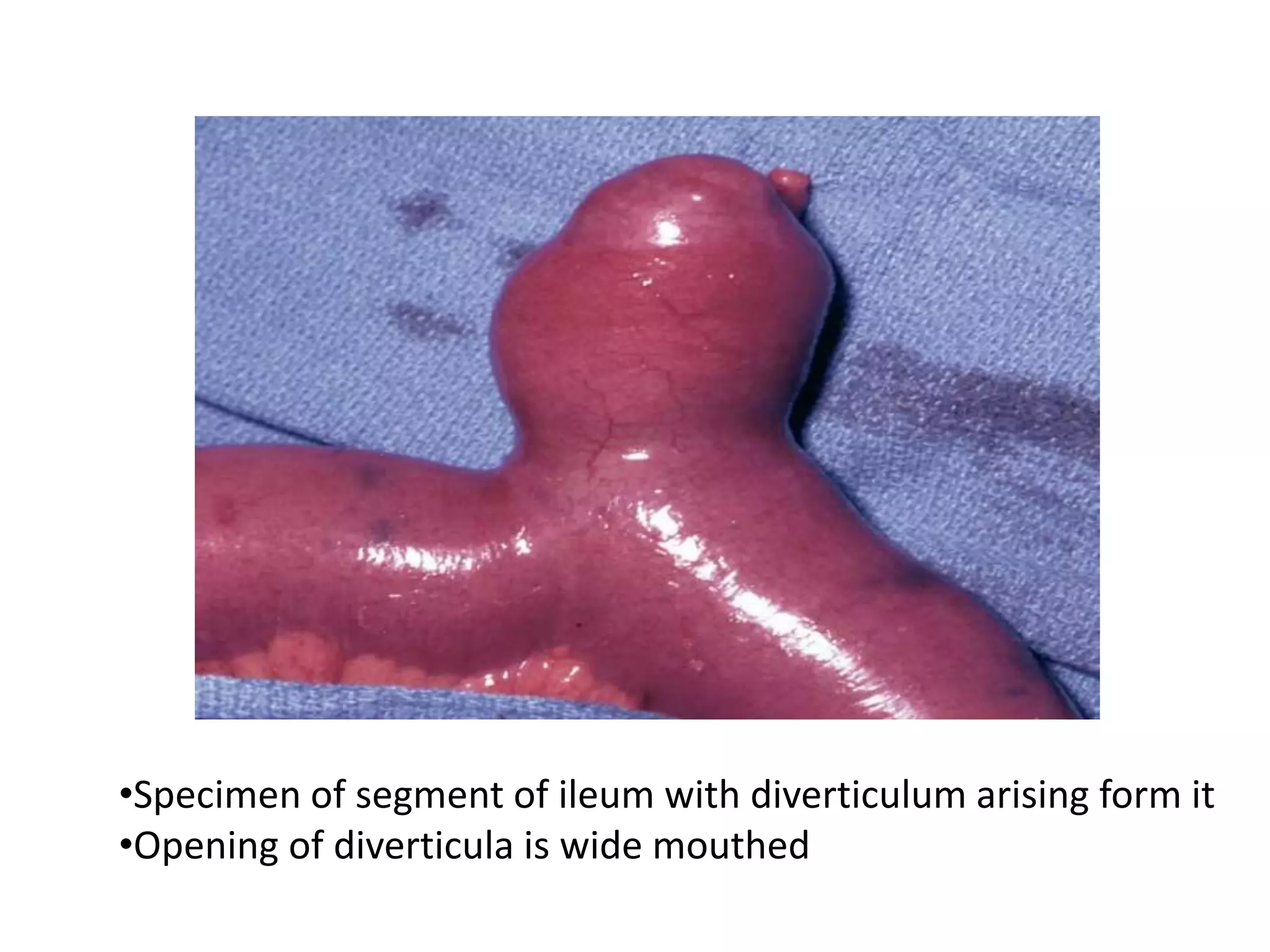 Surgical pathology specimens | PPTX