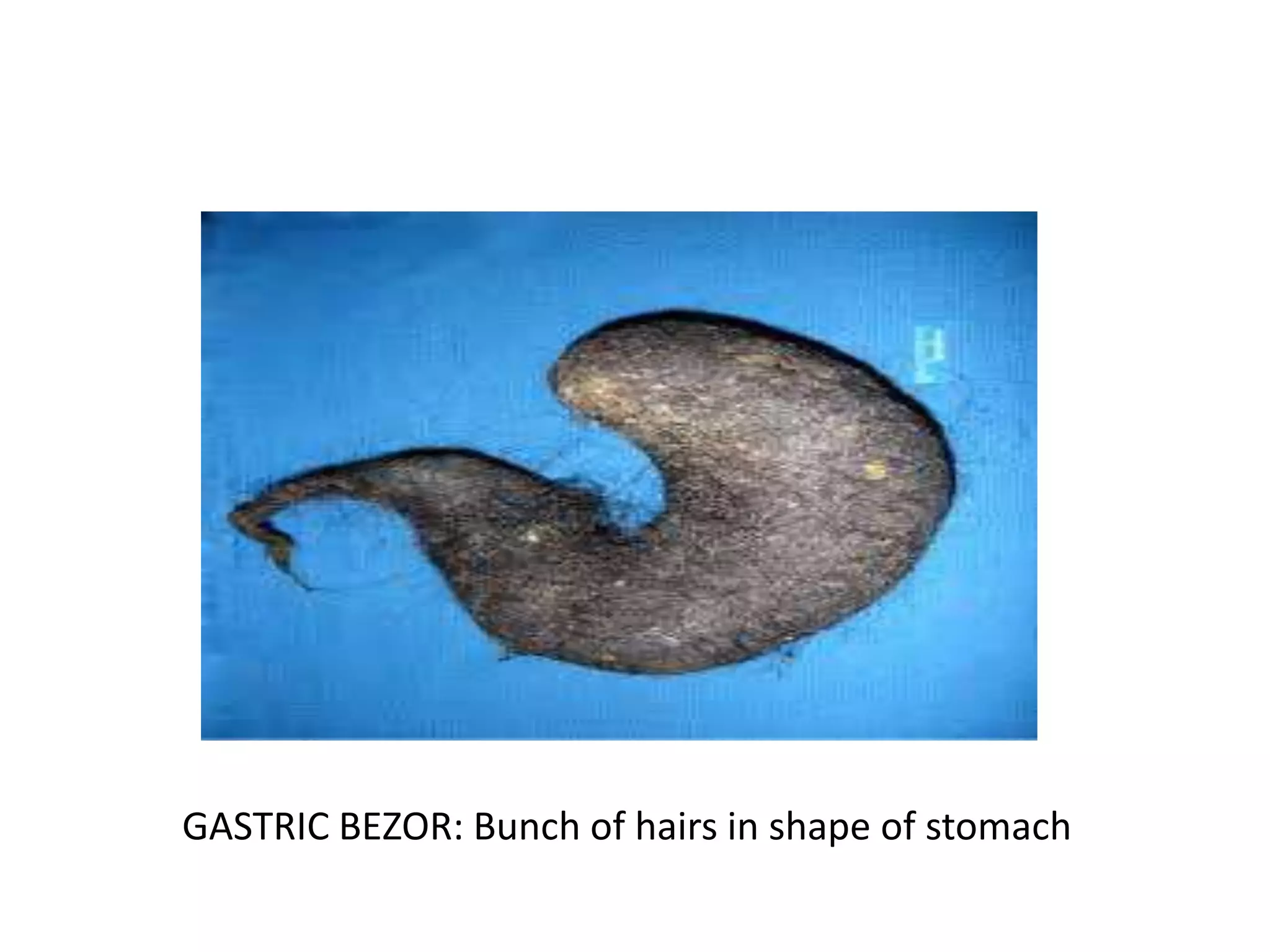 Surgical pathology specimens | PPTX