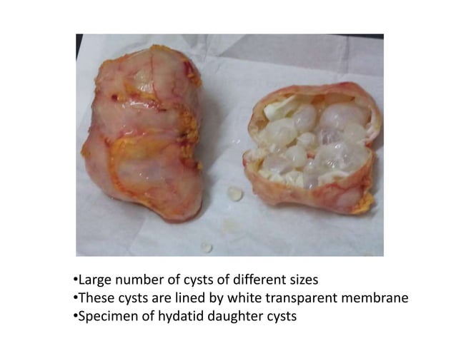 Surgical pathology specimens | PPTX