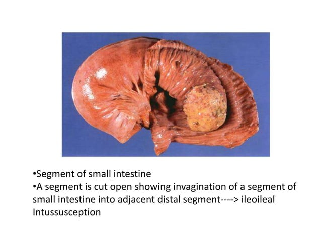Surgical pathology specimens | PPTX