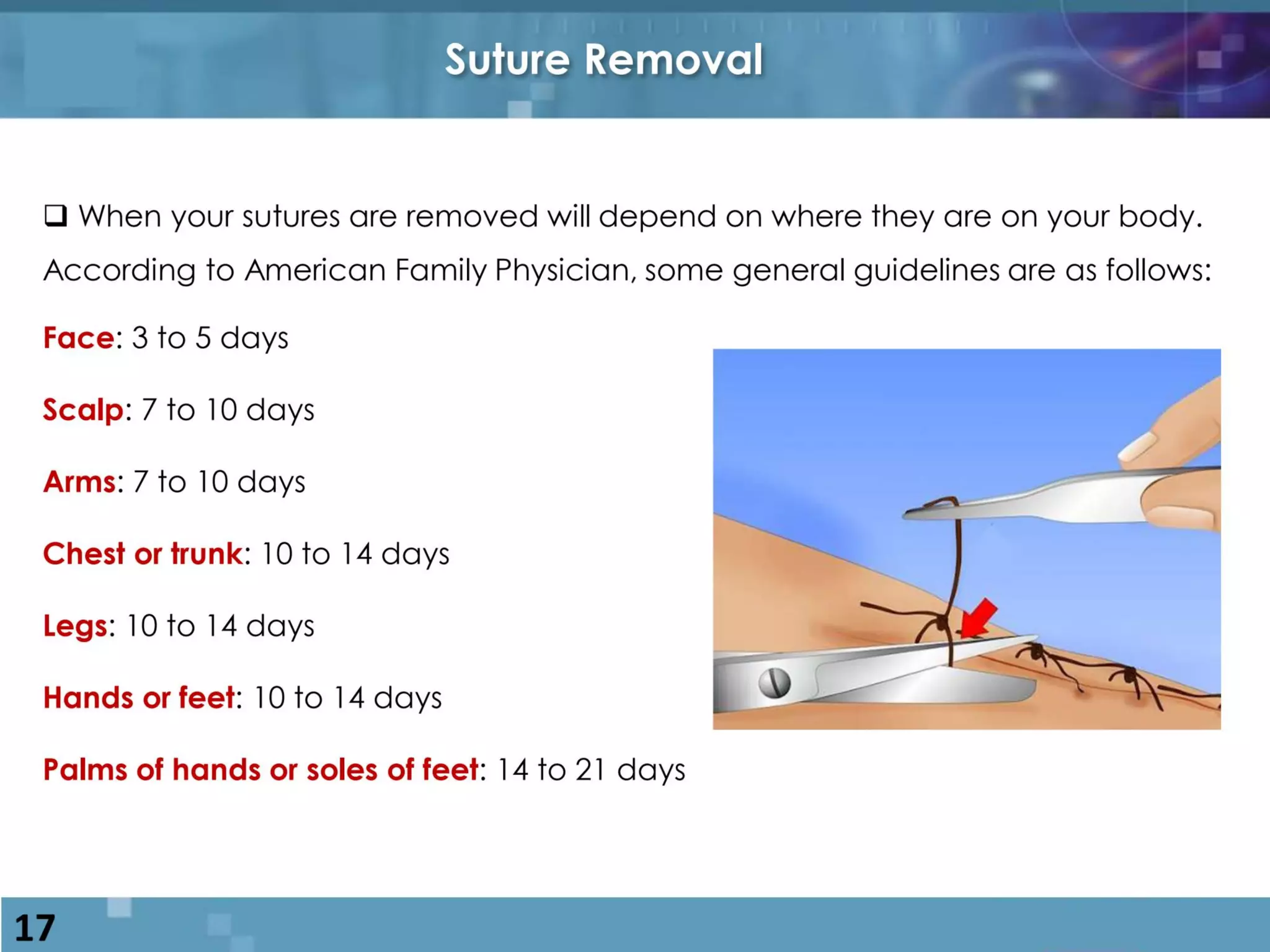 Surgical sutures and needles | PPT