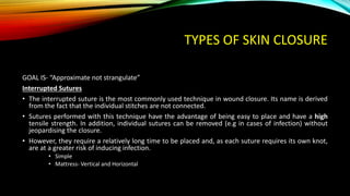 Surgical suturing techniques in OBGY | PPT