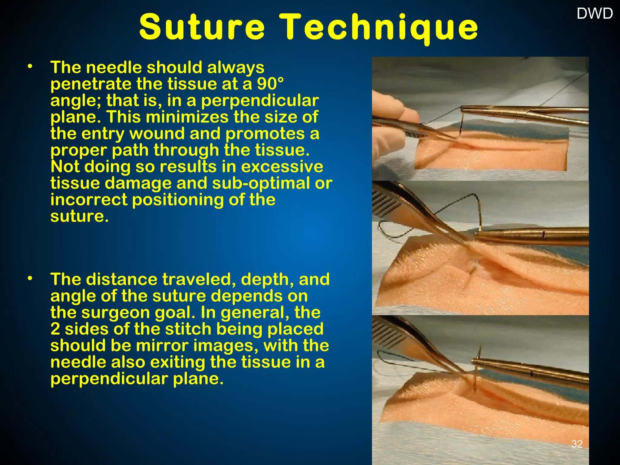 Surgical Sutures and Suturing Techniques | PPT