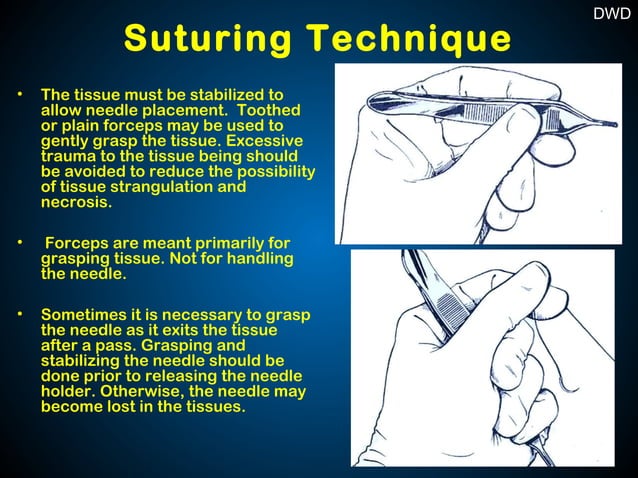 Surgical Sutures and Suturing Techniques | PPT | First Aid | Injuries