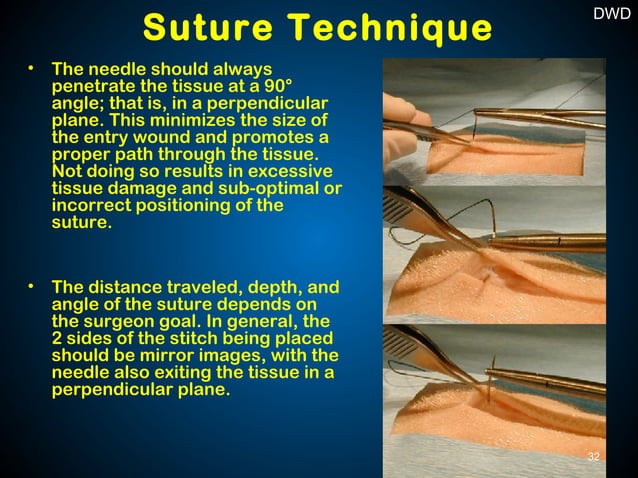 Surgical Sutures and Suturing Techniques | PPT