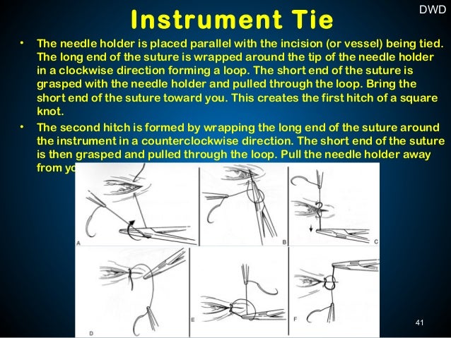 Surgical Sutures and Suturing Techniques