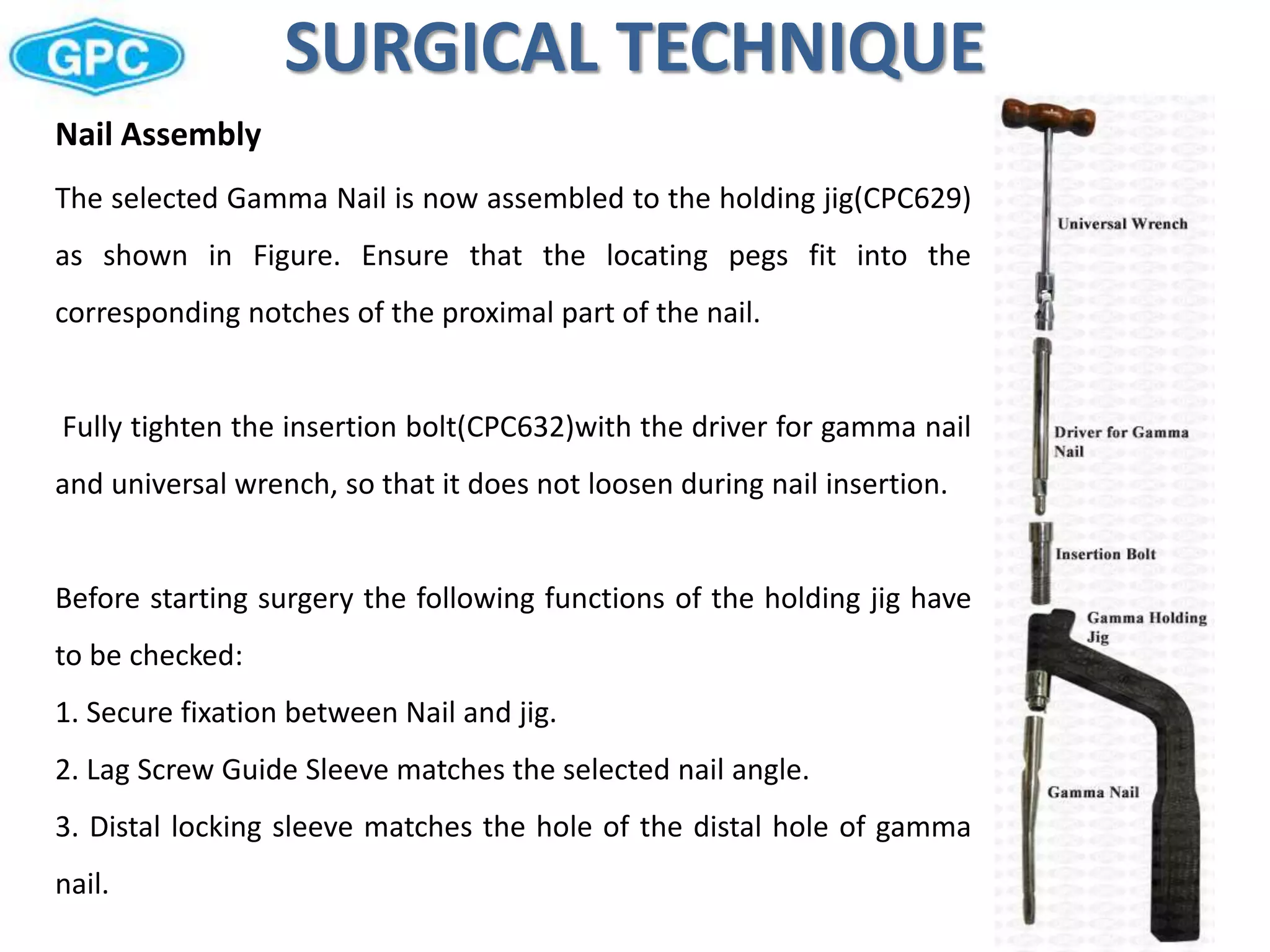 Surgical technique for gama nail | PPTX