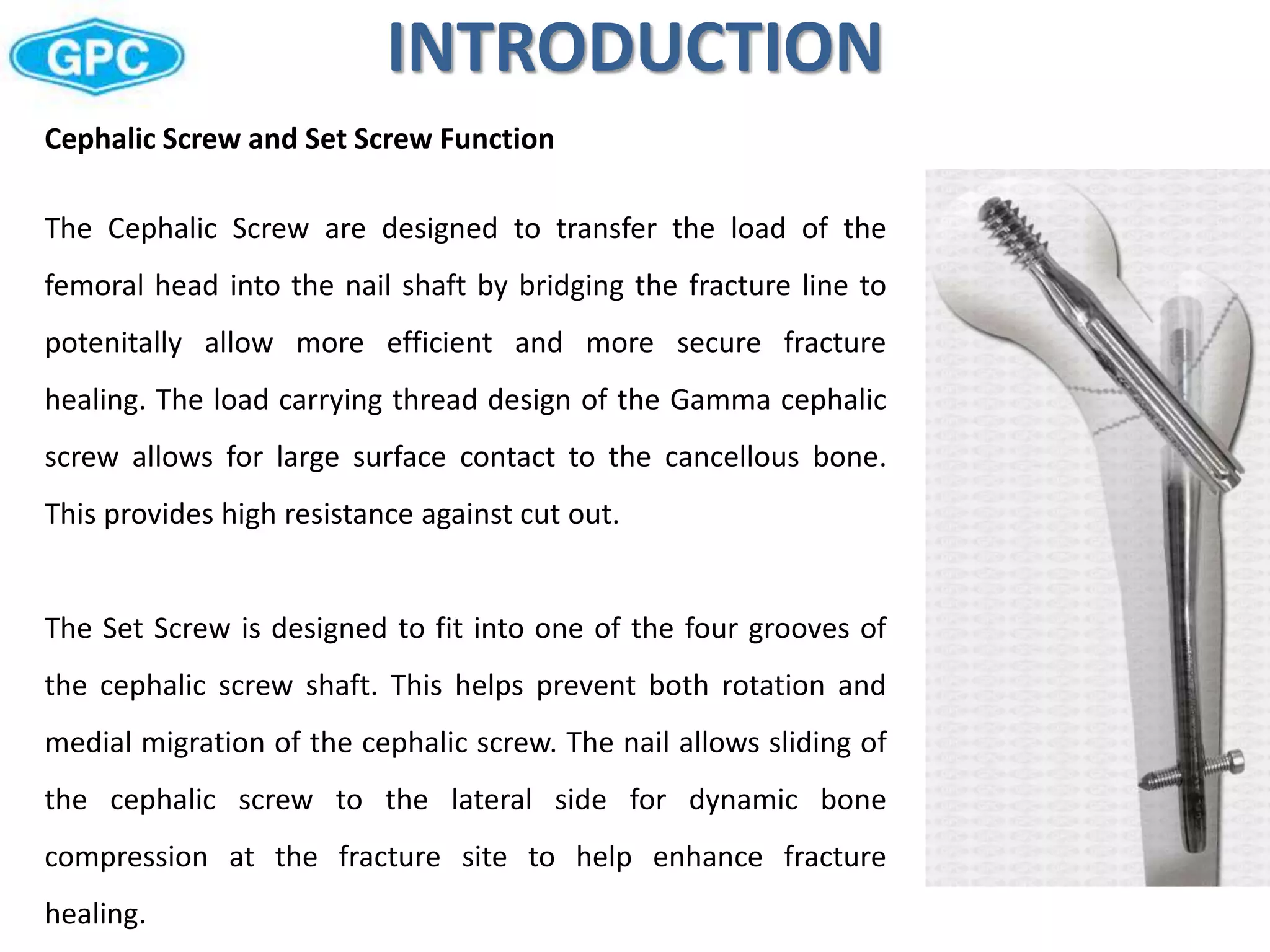 Surgical technique for gama nail | PPTX
