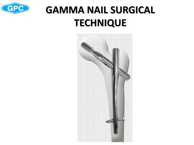 Surgical technique for gama nail | PPTX | Death, Injury, or Military ...