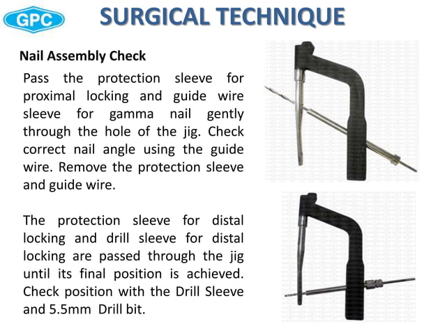 Surgical technique for gama nail | PPTX | Death, Injury, or Military ...