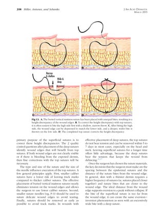 Surgical technique for optimal outcomes2 | PDF