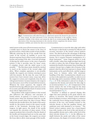 Surgical technique for optimal outcomes2 | PDF