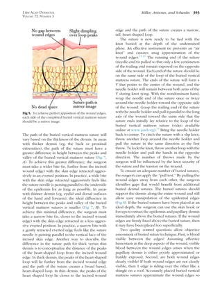 Surgical technique for optimal outcomes2 | PDF