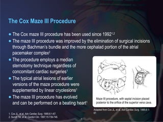 Different Surgical Techniques for Ablation.ppt
